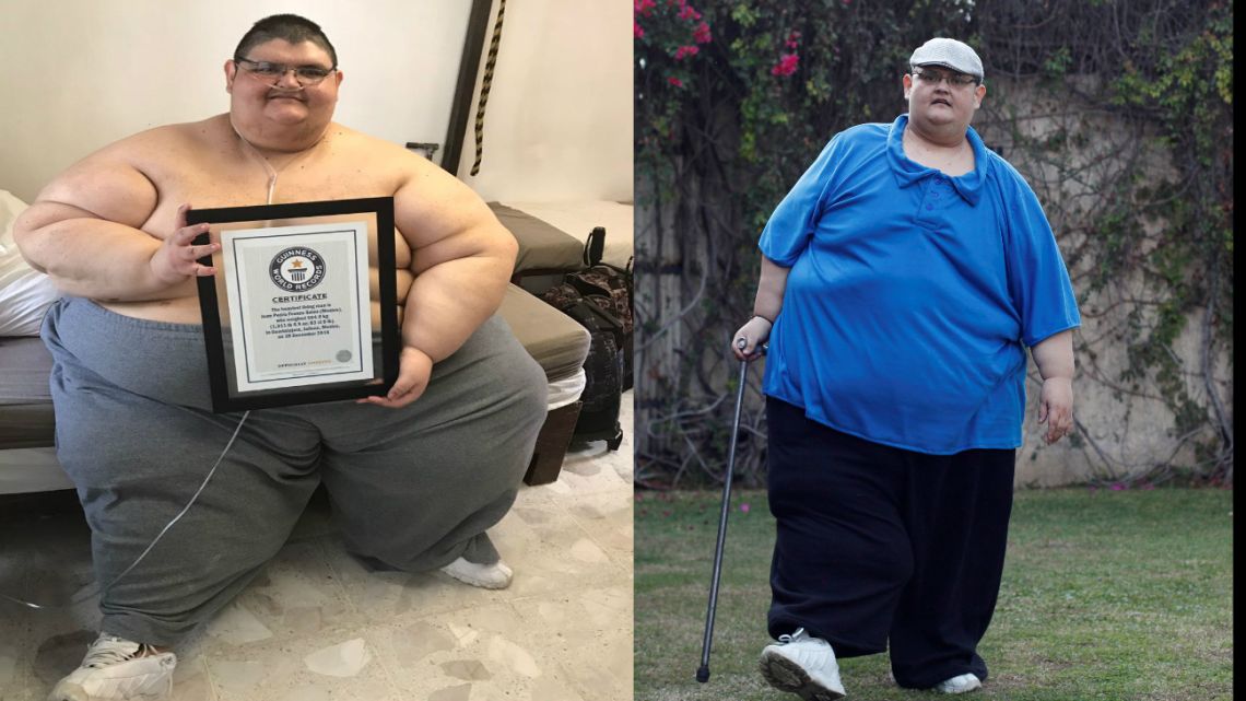 Juan Pedro Franco, l'homme le plus gros du monde qui a perdu 300kg