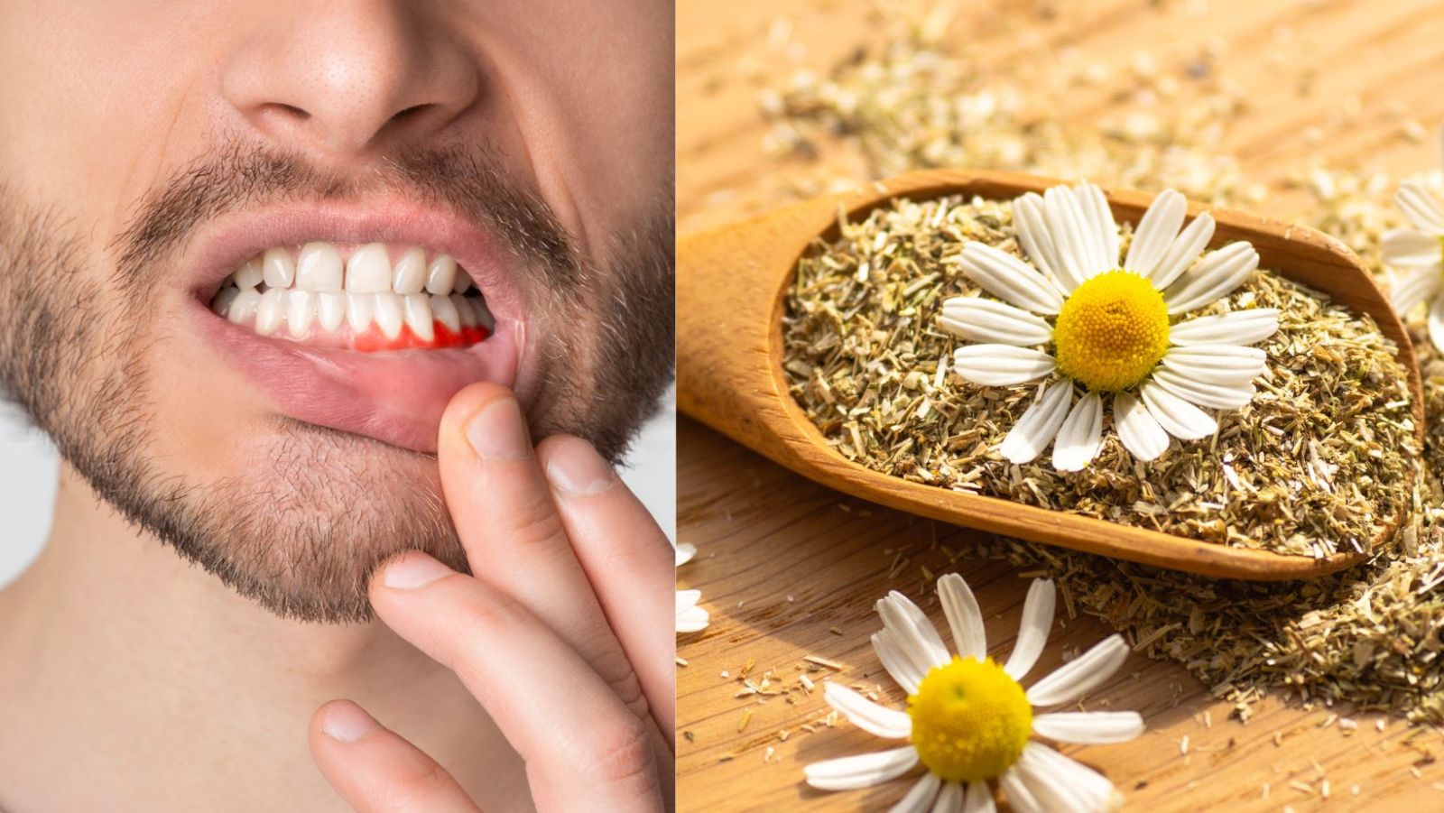 Les 5 remèdes de grand-mère pour soulager les douleurs aux gencives